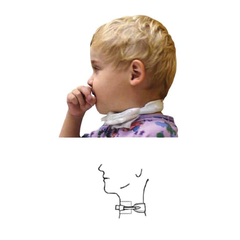 Catapult TurtleTub Swaddle Bath - MED Alliance Group, Inc.